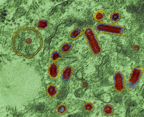 Rabies Infected Cell Photograph By Eye Of Science Pixels