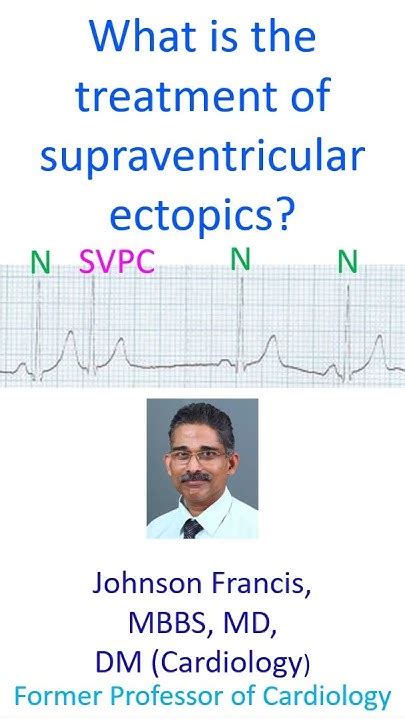 What Is The Treatment Of Supraventricular Ectopics Youtube