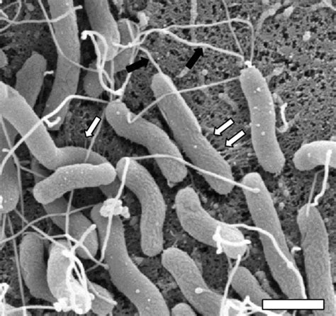 Heli Pylori Bacteria Symptoms Helicobacter Pylori Infection