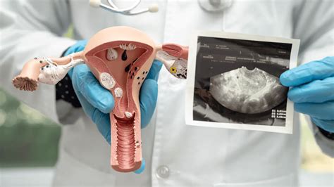 Cervical Cancer Treatment Program Cubaheal