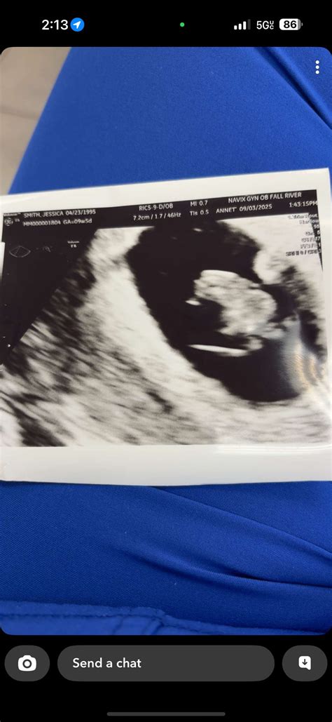 Steven Tanguay So To Early To Tell The Sex Yet But We Facebook