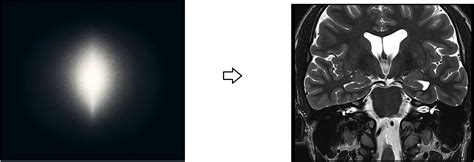 Mri K Space Physics Behind K Space And Practical Applications