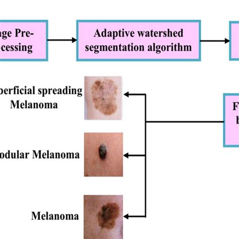 Melanoma Classification Performance Using Fractal Neural Network Based Download Scientific