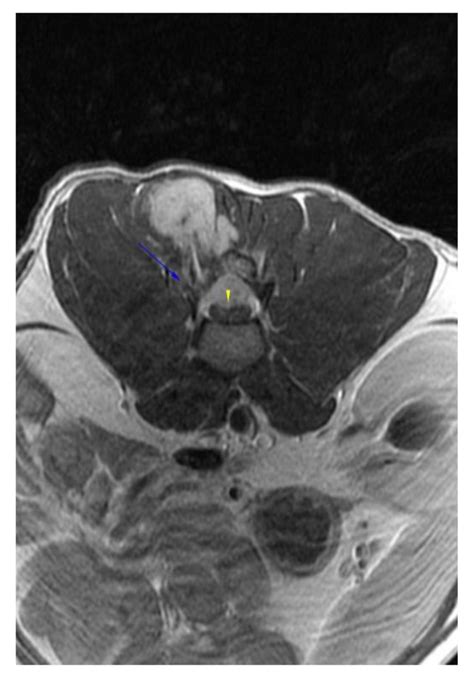 Successful Treatment Of Vertebral Osteosarcoma In A Cat Using Marginal