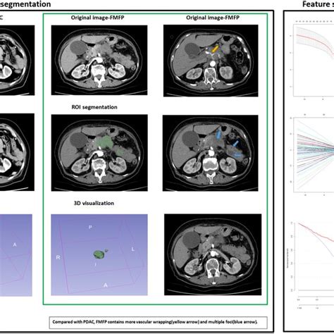Univariable Logistic Regression Analysis Of Clinical And Cmr Variables