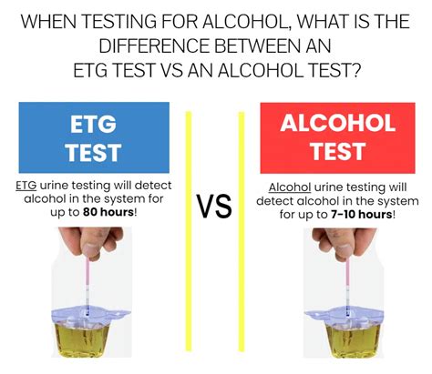 Etg Alcohol Urine Test Results Price Online