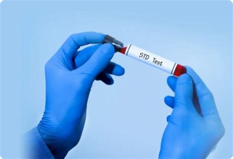 Confidential Std And Serology Blood Tests Andrology Center
