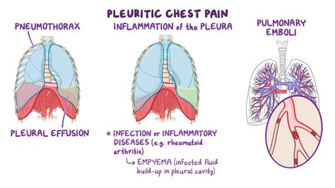 Lung Anatomy Pleura