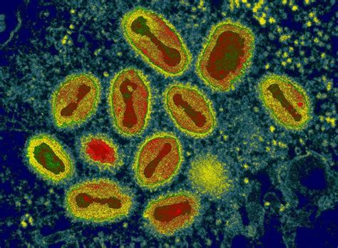 Drug To Treat Smallpox Approved By F D A A Move Against Bioterrorism