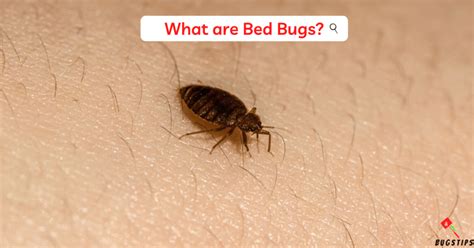 Bed Bugs Vs Scabies 5 Key Differences And Similarities With Easy Prevention Bugstips