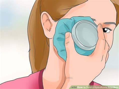 4 Ways To Treat A Hydrofluoric Acid Burn Wikihow