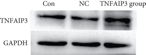 The Tnfaip3 Expression In The Three Groups Download Scientific Diagram