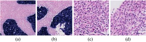 Examples Of Eber And Hande Images A B Are Examples Of Eber Staining Download Scientific