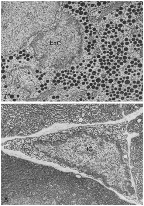 Interstitial Cells Ic Are Found Within The Intercellular Spaces And