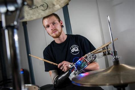 A Robotic Drum Prosthesis Project Video Open Electronics