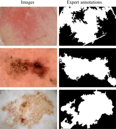 Examples Of Noisy Expert Annotations Download Scientific Diagram