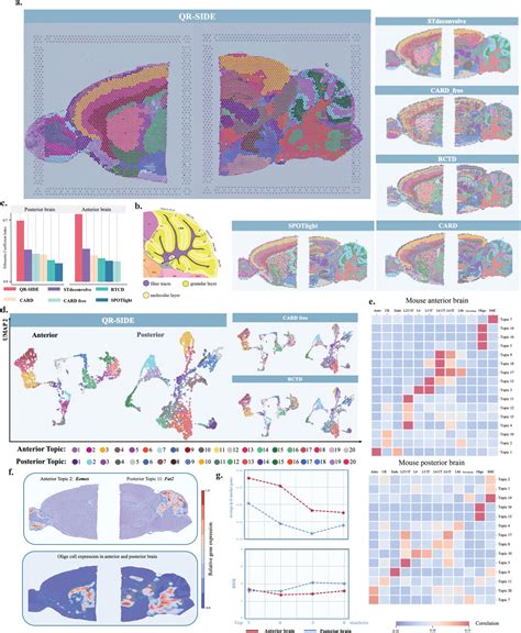 Robust Spatial Cell‐type Deconvolution With Qualitative Reference For Spatial Transcriptomics