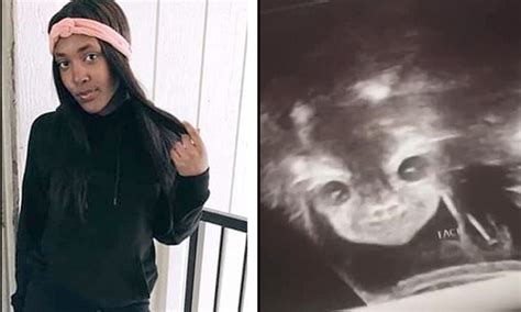 యువతి కడుపులో పెరుగుతున్న దెయ్యం పిల్ల స్కానింగ్‌ చేసిన డాక్టర్‌కే భయం వేసిందట