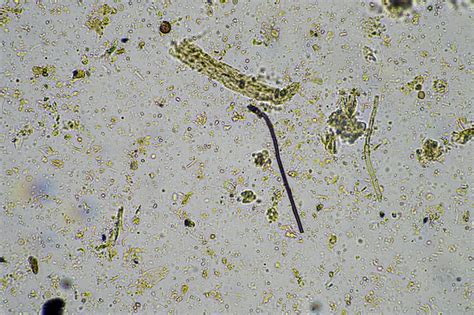 Premium Photo Soil Microbes Under The Microscope Microorganisms With