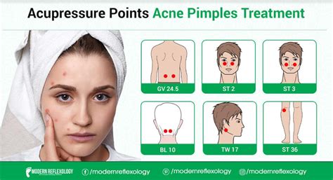 Acupressure Points For Pimples Treatment At Home Artofit
