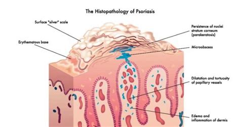 Building Your Practice Bioelectronics Expands Known Inflammation