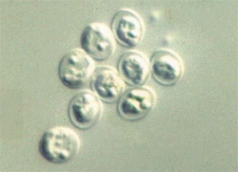 پل ایده‌آل پارس کریپتوسپوریدیوم