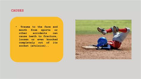 Dental Avulsion Pptx