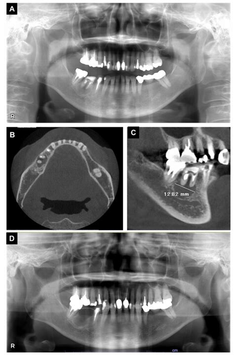 X Ray Examination Findings During The Initial Visit A Panoramic