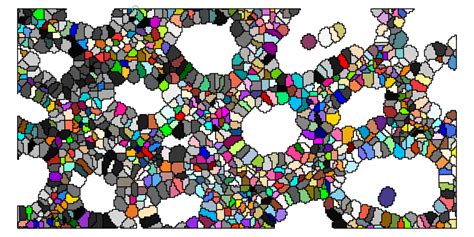 16 Workflow Visium Hd Segmented Orchestrating Spatial