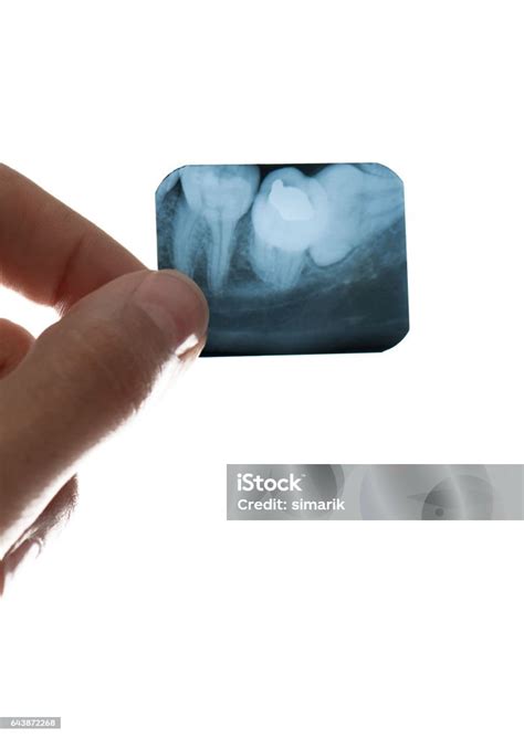 Rontgen Gigi Foto Stok Unduh Gambar Sekarang Gambar X Ray Teknik