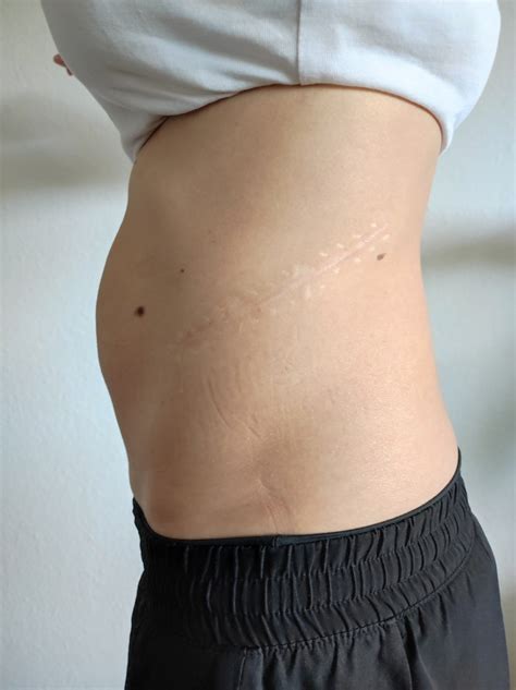 Tupler Technik Pelveasy