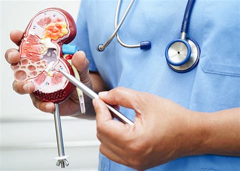 Nephrectomy Surgery Procedure And Care Dr Gaurav Aggarwal