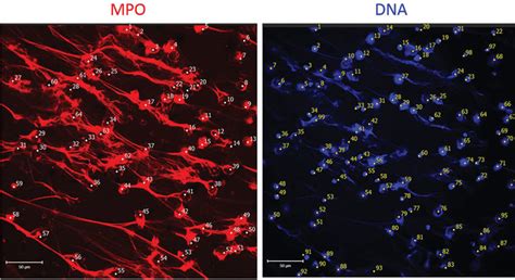 41 2 Quantification Of Nets By Immunofluorescence Neutrophils Were Download Scientific Diagram