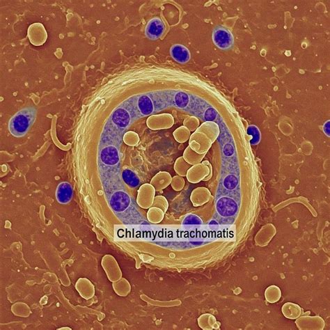 Chlamydia Test And Treatment In Derma Clinic Kathmandu Nepal