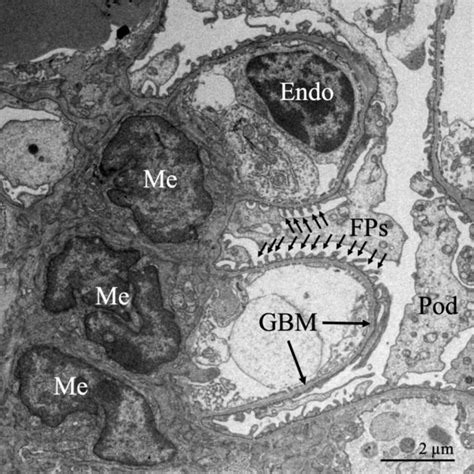 Transmission Electron Microscopic Image Of The Glomerulus From An Adult