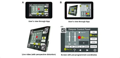 Reference Marker Detection A Four Marker Approach And B Single Download Scientific