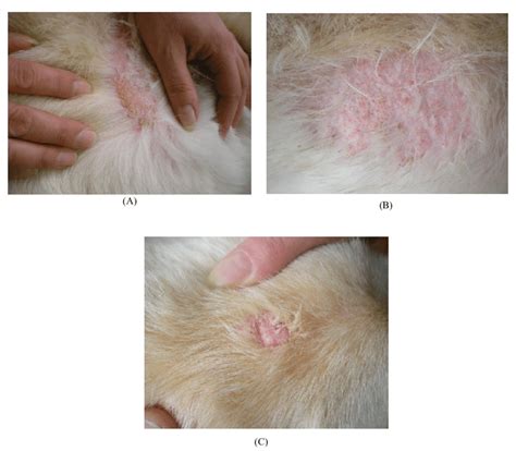 A Diffuse Impetigo Like Dermatitis At Hair Loss Area B Download