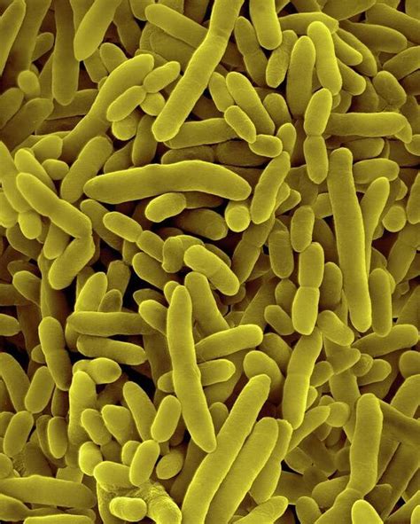 Pseudomonas Putida Poster By Science Photo Library Science Photo Gallery