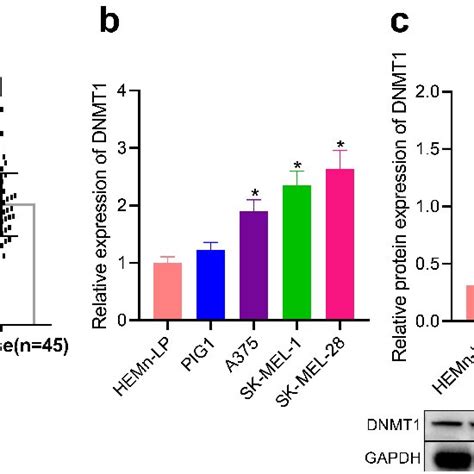 Dnmt1 Is Overexpressed In Melanoma And Affects The Malignant Phenotypes Download Scientific