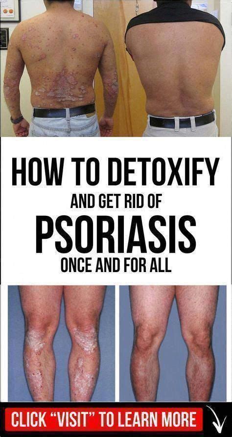 Exercises To Get Rid Of Cellulite On Thighs What Works And What Doesn T