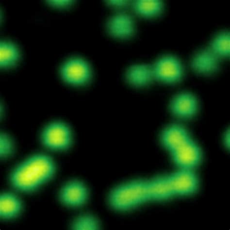 Microtime 200 Sted Time Resolved Confocal Fluorescence Microscope With Super Resolution