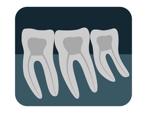 Premium Vector Xray Of Human Teeth Three Healthy Molars On An Xray