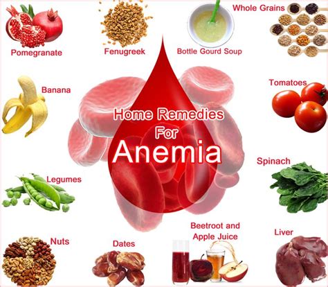 What Is A Treatment For Anemia At Kai Haddon Blog