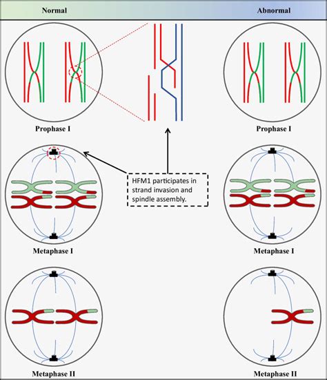 Novel Deleterious Splicing Variant In Hfm1 Causes Gametogenesis Defect And Recurrent