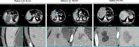 Label Free Liver Tumor Segmentation