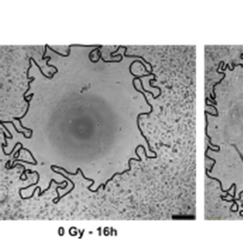 Keratinocyte Migration Of The Irradiated Control Groups Without Growth