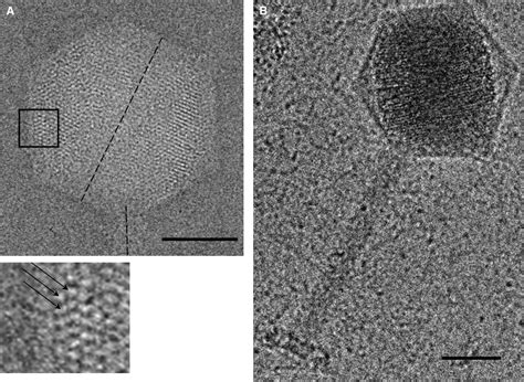 Bacteriophage Electron Micrograph