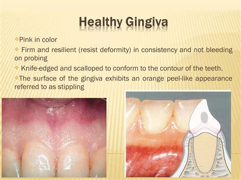 Anatomy Of The Periodontium Ppt