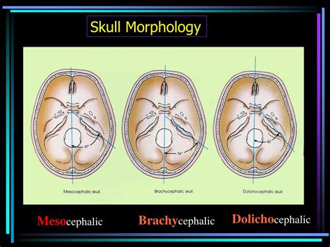 Ppt Skull Positioning Dmi 55 Powerpoint Presentation Free Download Id6745972