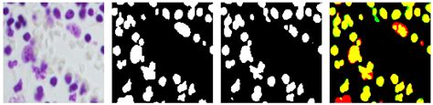 Cellular Nucleus Image Segmentation Project By Christopher Bui Tds